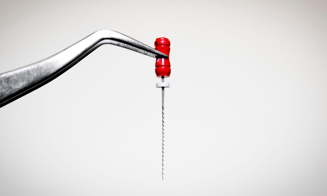 Rotfyllning: Behandling och Pris - Aqua Dental